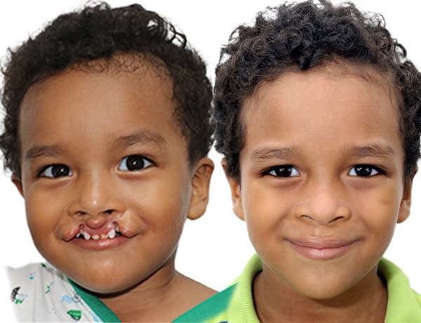 Neythan - Global Smile Foundation