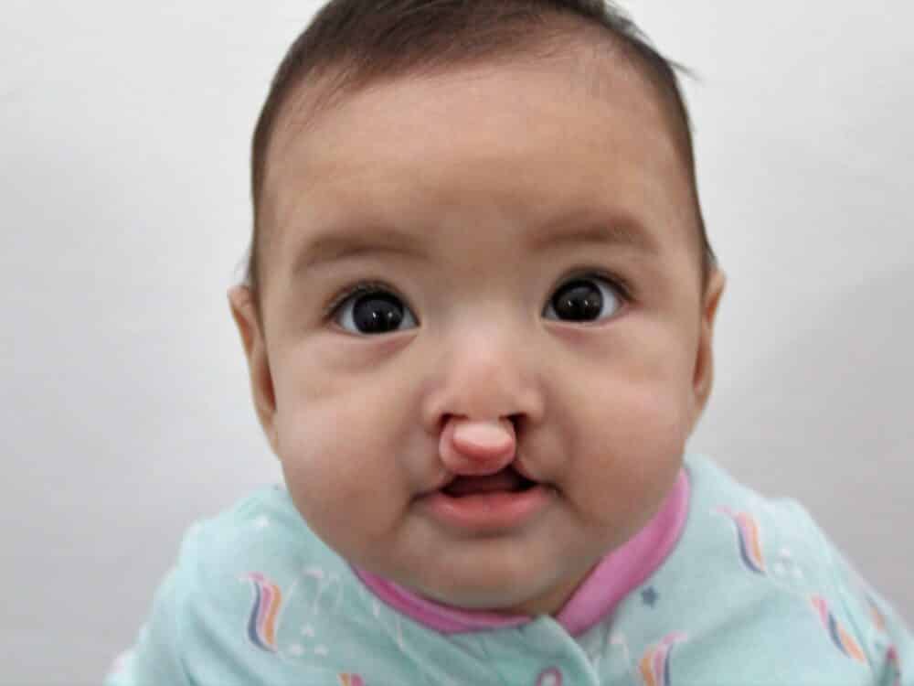 October Smile of the Month - Global Smile Foundation