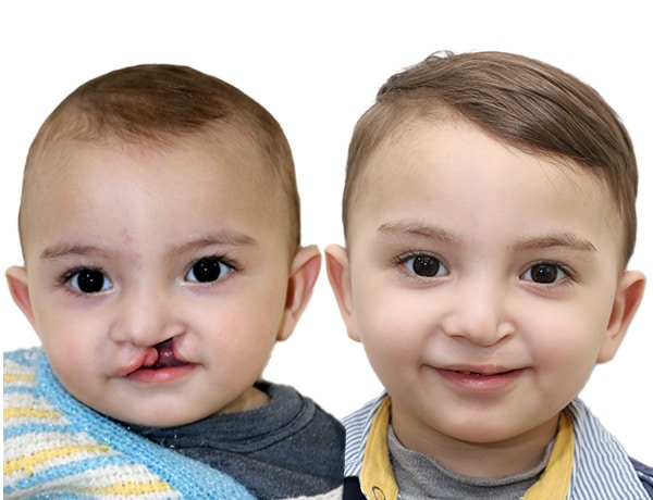 Othman - Global Smile Foundation